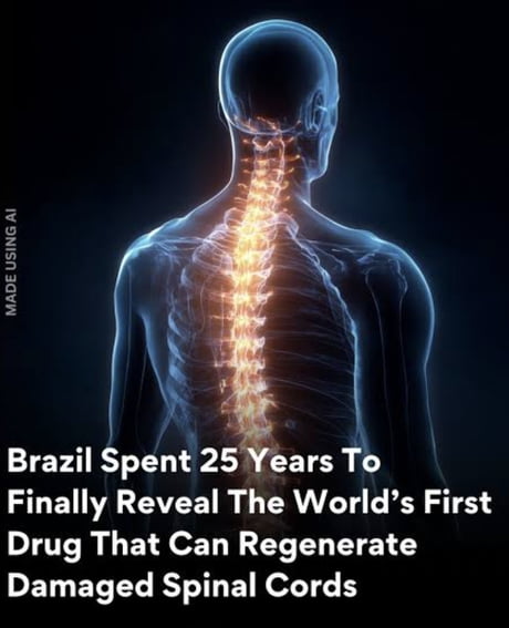 Spine Memes Xray Humor, Radiology Humor. Yup, It Always Points To The
