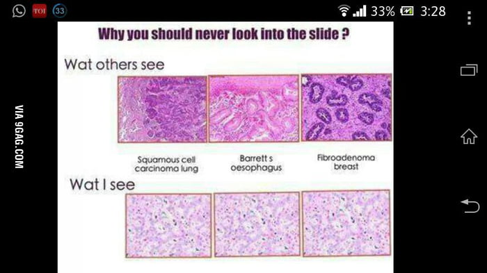 Histology slides for a medicine student - 9GAG