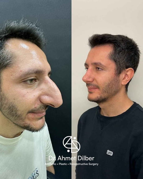 Memes Cirujano Plastico Your Body, Your Self, Your Surgeon, His