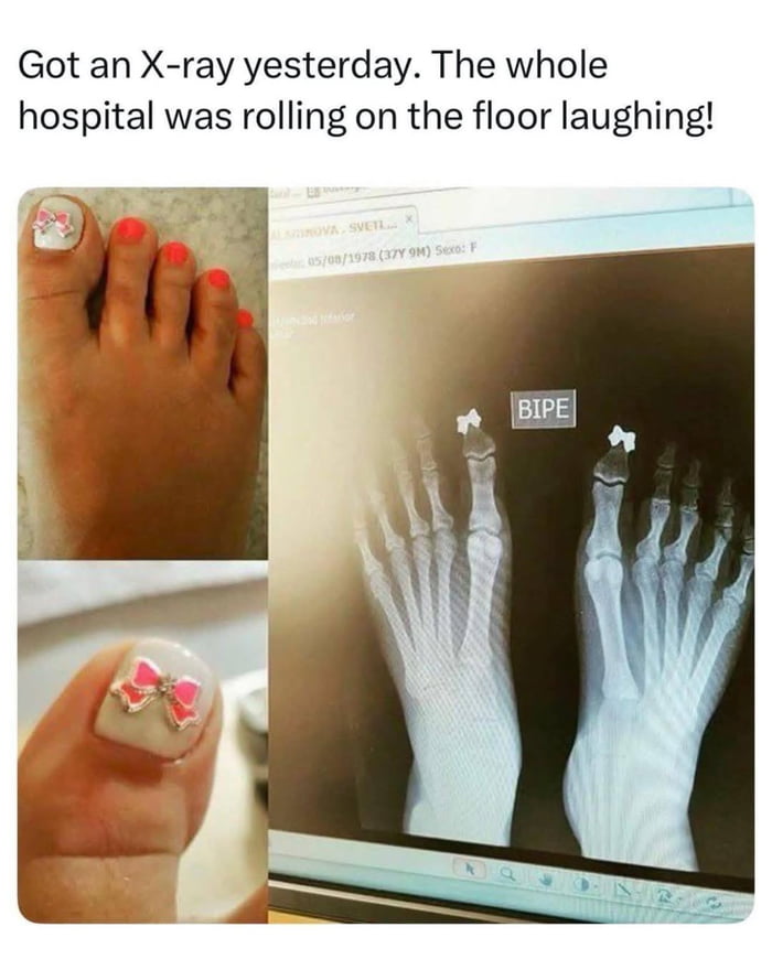 When your style is so strong it shows up on the X-ray. - 9GAG