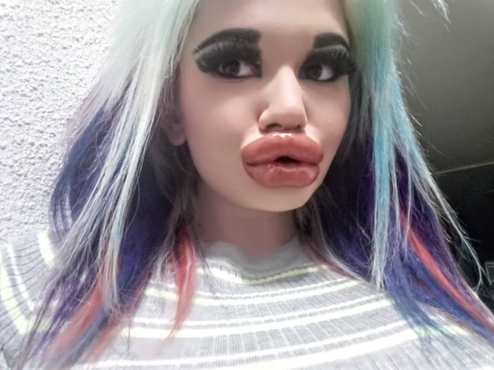 Woman Is Pursuing For The Biggest Lips In The World - 9GAG