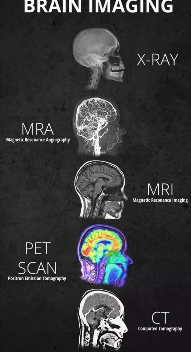 Brain imaging types - 9GAG