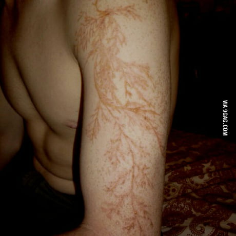 Lightning Scars Back