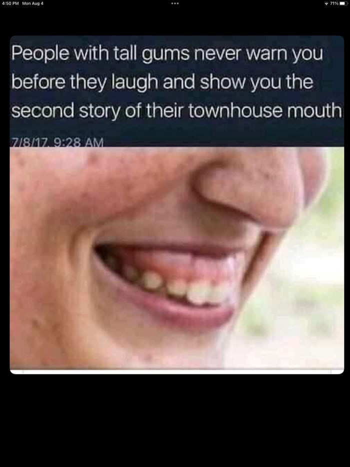 Dolphin Teeth - 9GAG